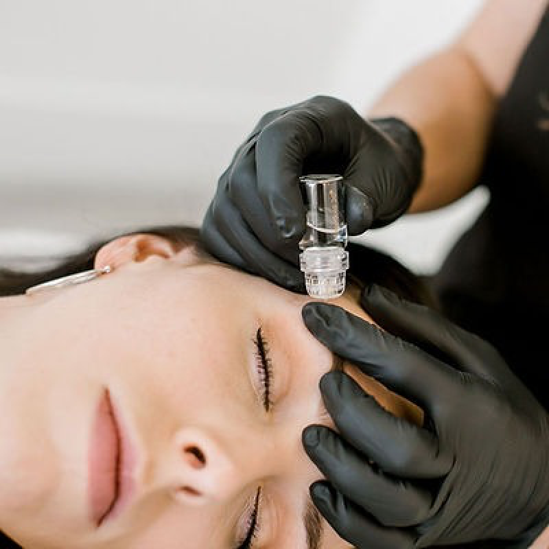 Unveiling the Beauty of Gold: Mesogold's Role in Skin Perfection ...